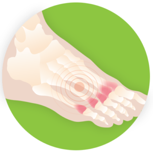 Metatarsalgia - Orthoquest