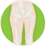 Leg Length Discrepancy - Orthoquest