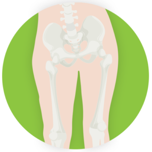 Leg Length Discrepancy - Orthoquest