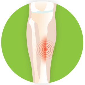 Shin Splint Treatment - Orthoquest